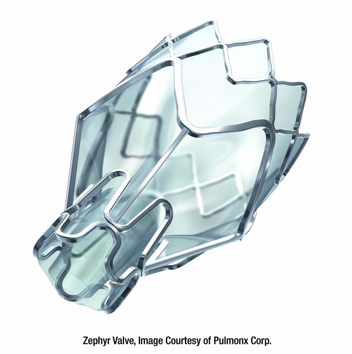 Zephyr Valve – Med Center Health